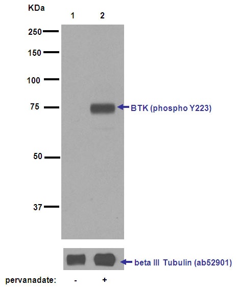 Anti-BTK (phospho Y223) antibody [EP420Y] (ab68217) | Abcam