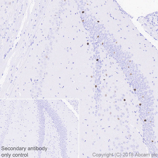Anti-c-Fos antibody [EPR21930-238] - recombinant (ab222699) | Abcam