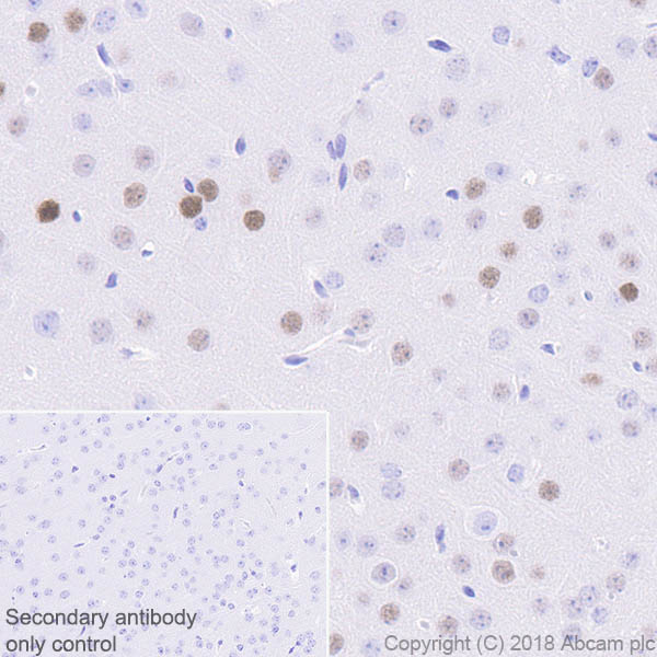 Anti-c-Fos antibody [EPR21930-238] - recombinant (ab222699) | Abcam