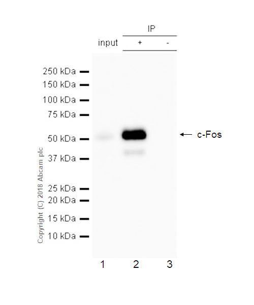 Anti-c-Fos antibody [EPR21930-238] - recombinant (ab222699) | Abcam