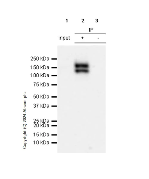 Anti-c-Kit antibody [RM1190] KO Tested (ab317843) | Abcam