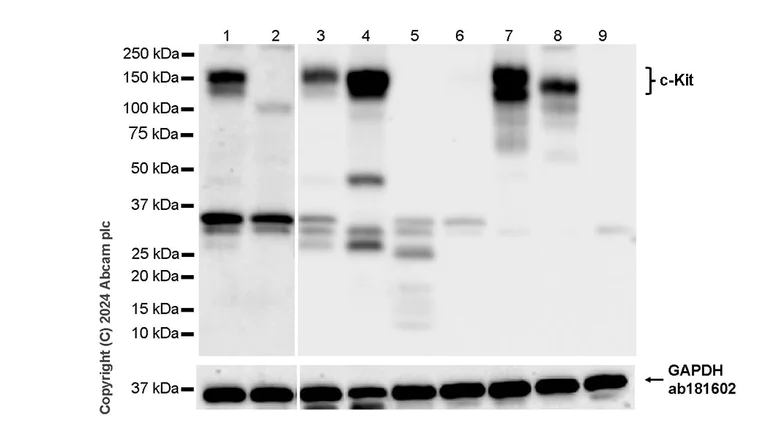 Anti-c-Kit antibody [RM1190] KO Tested (ab317843) | Abcam