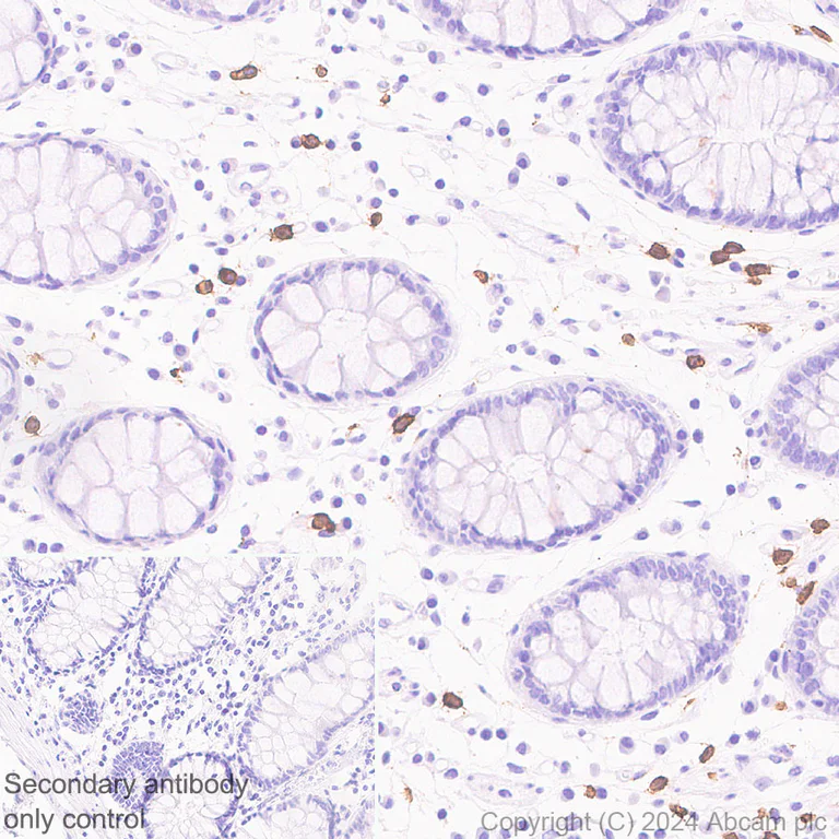 Anti-c-Kit antibody [RM1190] - BSA and Azide free (ab317844) | Abcam