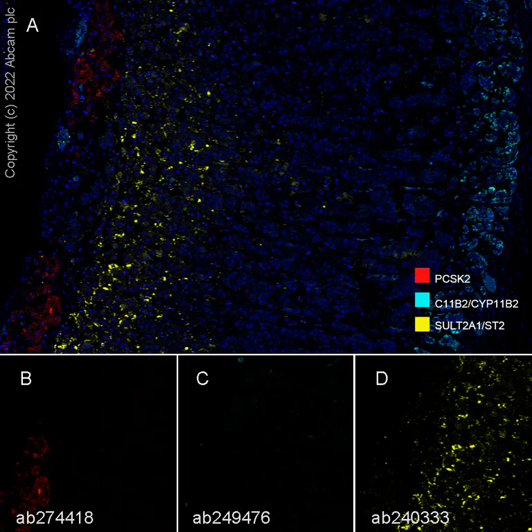 Anti-C11B2/CYP11B2 antibody [EPR10494] - BSA and Azide free (ab249476 ...