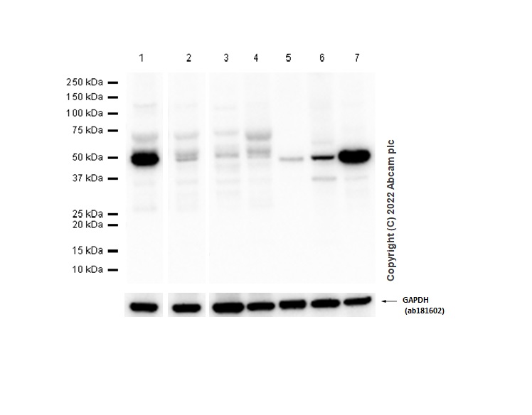 C11B2/CYP11B2抗体[EPR10495] (ab167413)| Abcam中文官网