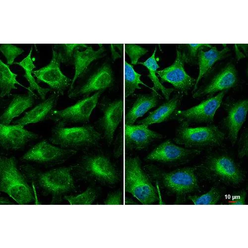Anti-C3 antibody [HL1643] (ab317099) | Abcam