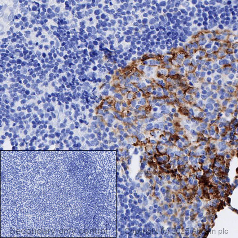 Anti-C4d antibody [SP91] - BSA and Azide free (ab236231) | Abcam