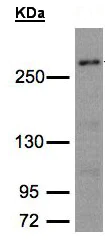 Anti-CAD antibody (ab97340) | Abcam