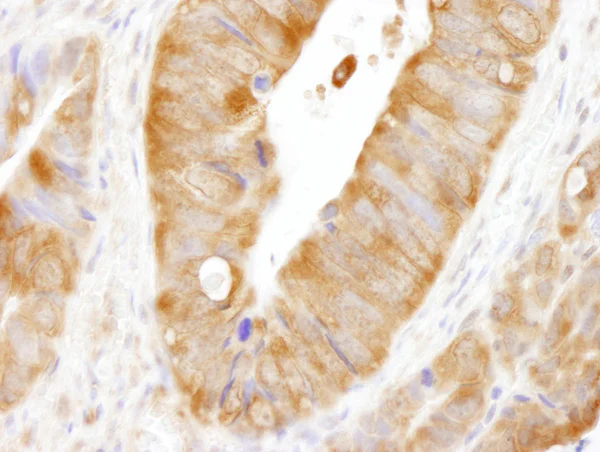 Anti-CAD antibody (ab99313) | Abcam