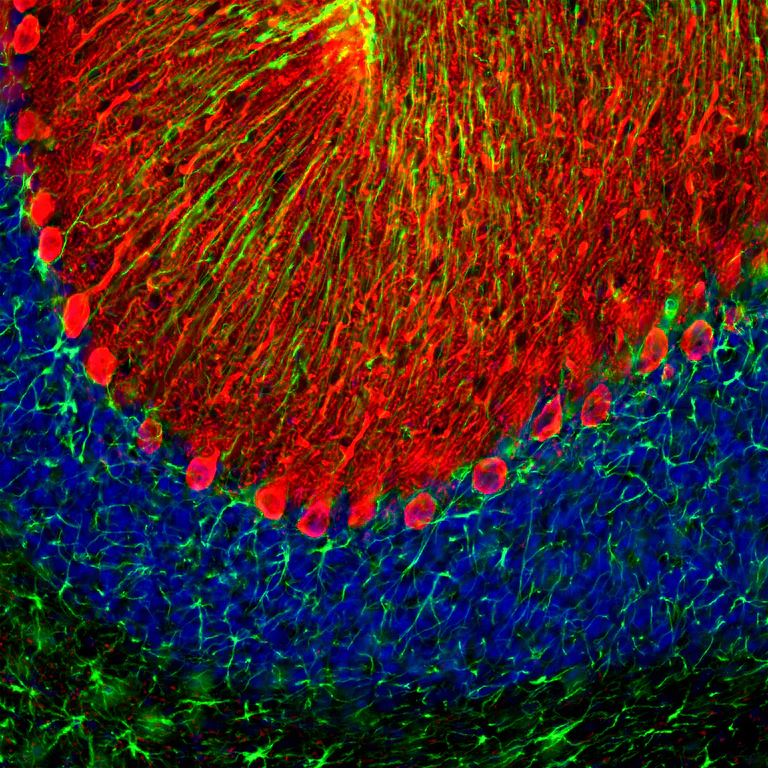 Anti-Calbindin antibody [5A9] (ab315202) | Abcam
