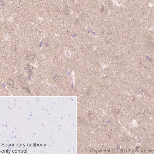 Anti-Calbindin antibody [EP3478] (ab108404) | Abcam