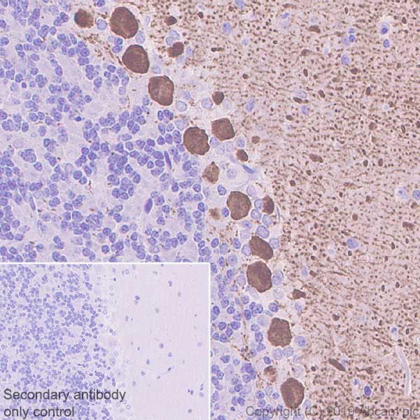 Anti-Calbindin antibody [EPR22698-236] (ab229915) | Abcam