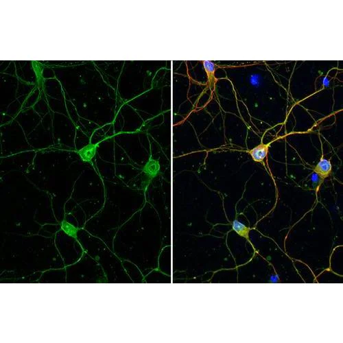 Anti-Calbindin + Calretinin antibody [HL1787] (ab317108) | Abcam