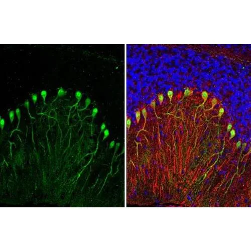 Anti-Calbindin + Calretinin antibody [HL1787] (ab317108) | Abcam