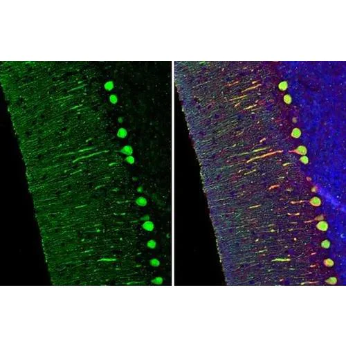 Anti-Calbindin + Calretinin antibody [HL1787] (ab317108) | Abcam