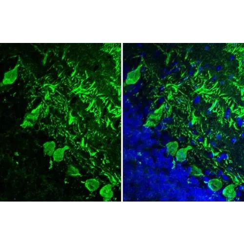Anti-Calbindin + Calretinin antibody [HL1787] (ab317108) | Abcam