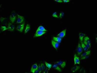 Anti-Calcium channel L type DHPR alpha 2 subunit/CACNA2D1 antibody ...