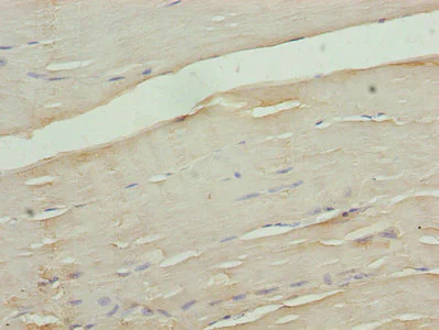Calcium channel L type DHPR alpha 2 subunit/CACNA2D1抗体 (ab238110 ...