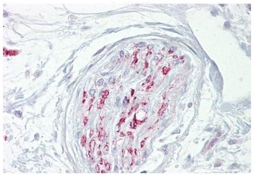 Anti-Calcium channel L type DHPR alpha 2 subunit/CACNA2D1 antibody ...
