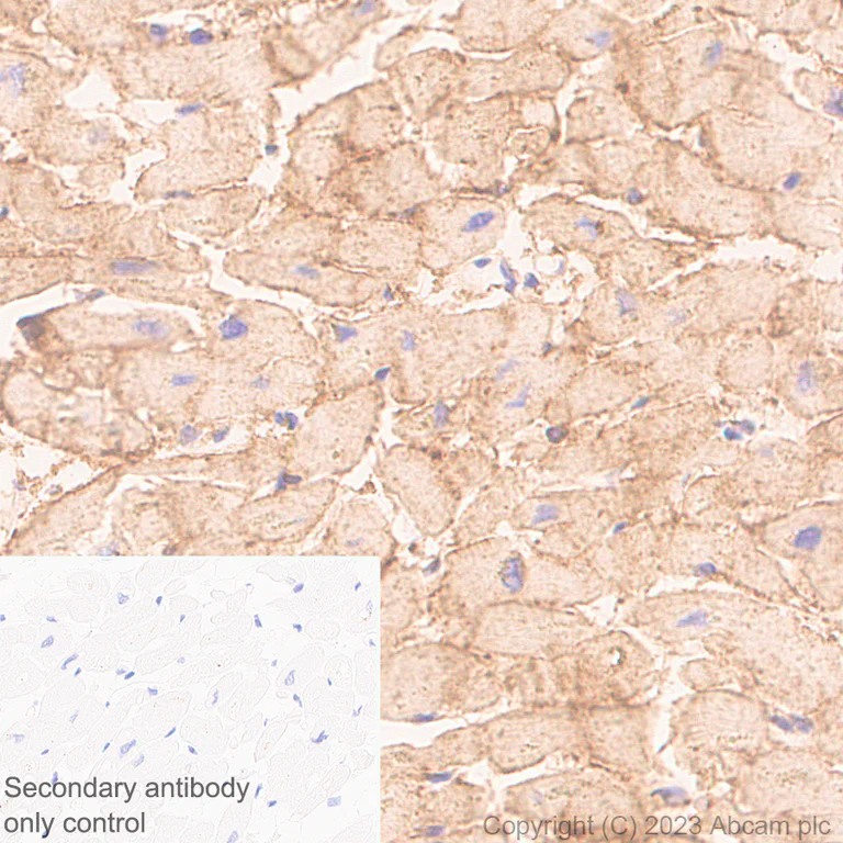 Calcium channel L type DHPR alpha 2 subunit/CACNA2D1抗体[EPR23267-59 ...