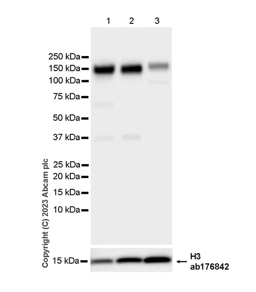 Anti-Calcium channel L type DHPR alpha 2 subunit/CACNA2D1 antibody ...