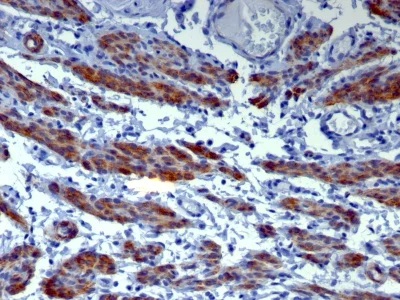 Anti-Caldesmon/CDM antibody [h-CALD] (ab233987) | Abcam