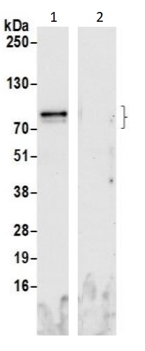 Anti-Calmegin antibody (ab240578) | Abcam