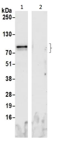 Anti-Calmegin antibody (ab240578) | Abcam