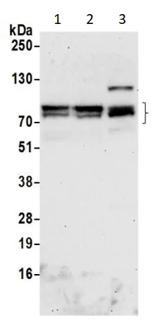 Anti-Calmegin antibody (ab240578) | Abcam