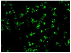 Anti-Calmegin antibody [EPR11832-11] - BSA and Azide free (ab249695 ...