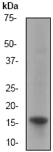 Anti-Calmodulin 1/2/3 antibody [EP799Y] - C-terminal (ab45689) | Abcam