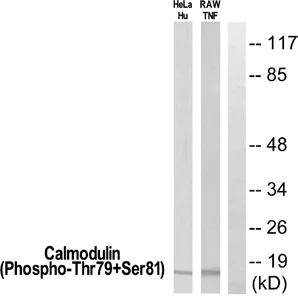 Anti-Calmodulin 1/2/3 (phospho T79 + S81) antibody (ab61001) | Abcam