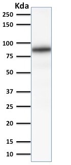 Anti-Calnexin antibody [CANX/1541] - N-terminal (ab218337) | Abcam