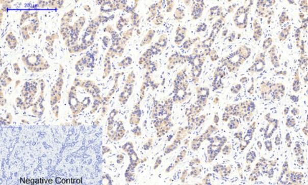 Anti-CaMK2 beta gamma delta (phospho T287) antibody (ab182647) | Abcam