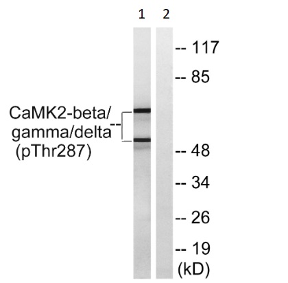 Anti-CaMK2 beta gamma delta (phospho T287) antibody (ab182647) | Abcam