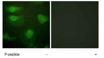 Anti-CaMKI (phospho T177) antibody (ab62215) | Abcam