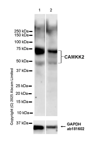 Anti-CAMKK2 antibody [EPR29771-501] (ab325433) | Abcam