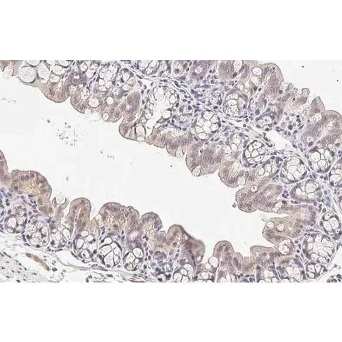 Anti-CARD10 antibody [HL2260] (ab317180) | Abcam中文官网