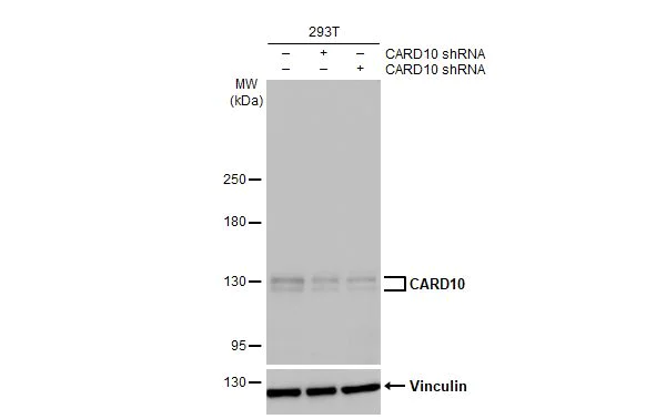 Anti-CARD10 antibody [HL2260] (ab317180) | Abcam中文官网