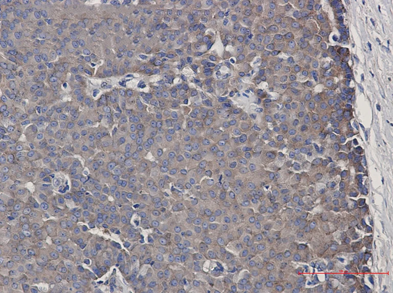 Anti-CARS antibody [S01-7D4] (ab317424) | Abcam