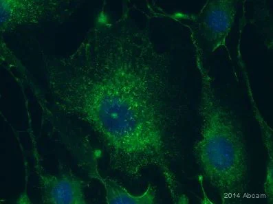 Caveolin-1抗体[7C8] - Caveolae Marker (ab17052)| Abcam中文官网