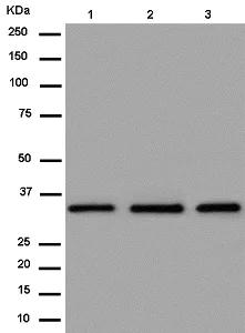 Anti-CBR3 antibody [EPR14129] - BSA and Azide free (ab250271) | Abcam