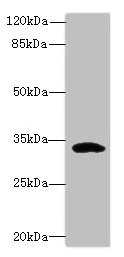 Anti-CCDC24 antibody (ab235512) | Abcam