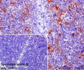 Anti-CCL25 antibody [EPR12388(2)] (ab200343) | Abcam