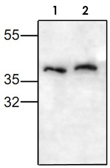 Anti-CCR1 antibody (ab19013) | Abcam