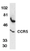 Anti-CCR5 antibody. Rabbit polyclonal (ab7346) | Abcam