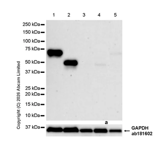 Anti-CCR5 antibody [EPR29865-504] (ab326722) | Abcam中文官网
