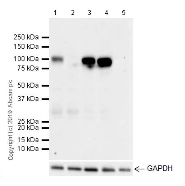 Anti-CD10 antibody [EPR22867-118] (ab256494) | Abcam