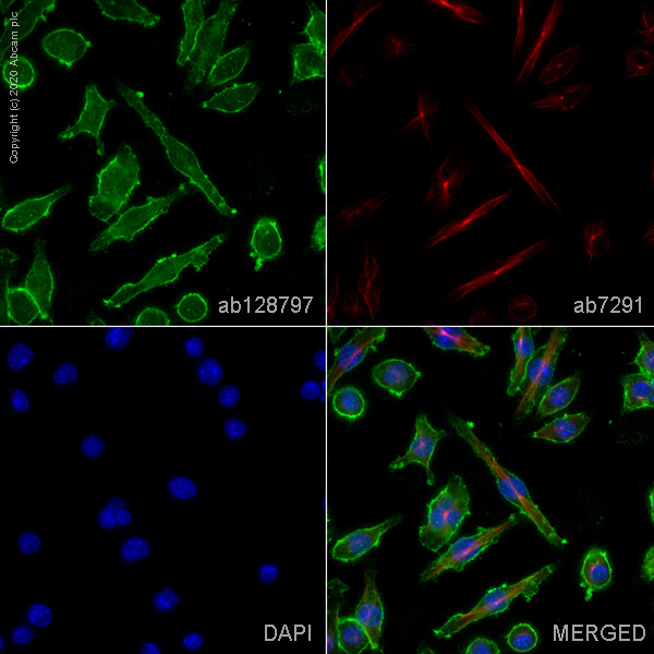 Anti-CD11b antibody (ab128797) | Abcam