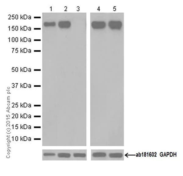 Anti-CD11b antibody [EPR19373] (ab184307) | Abcam